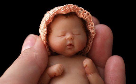 world smallest baby | UNP